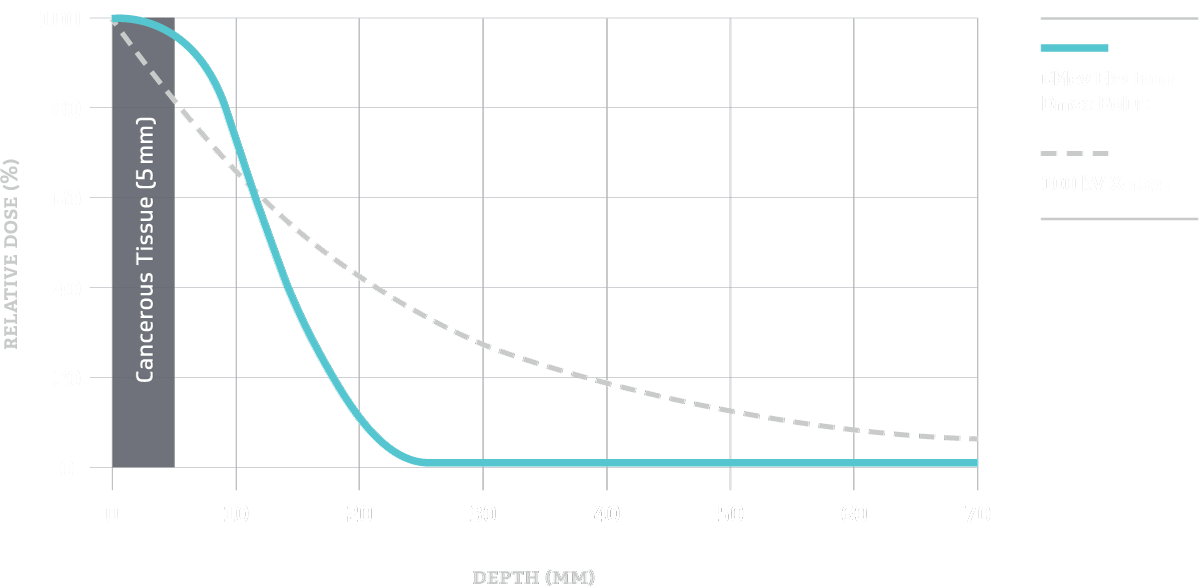 Electron Therapy for Skin Cancer and Dermatology - IntraOp